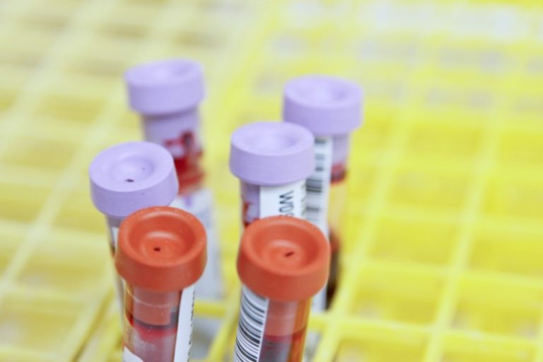 Leukemia Misdiagnosis Can I Sue Poulos And Coates LLP